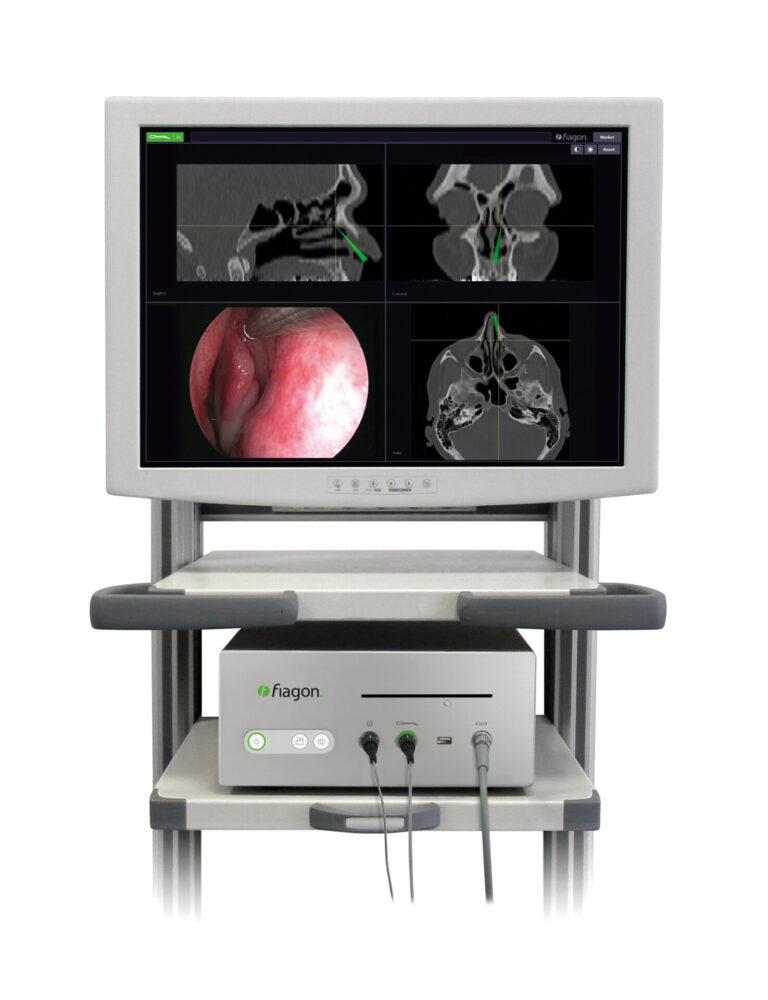 コブレーター2 サージェリー システム | 株式会社アダチ